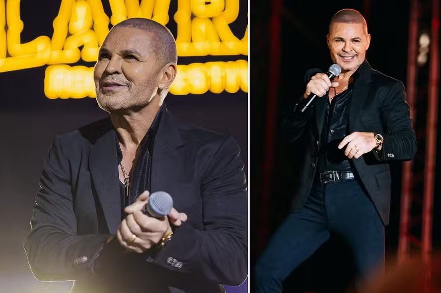 Eduardo Costa explica visual após surgir careca em show: ‘Usei muita ...